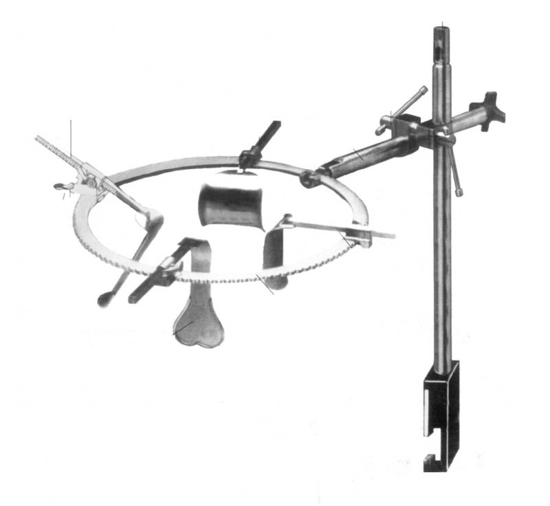 Bookwalter Retractor