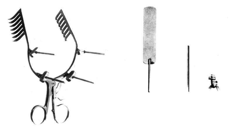 MISKIMON SELF-RETAINING RETRACTOR COMPLETE